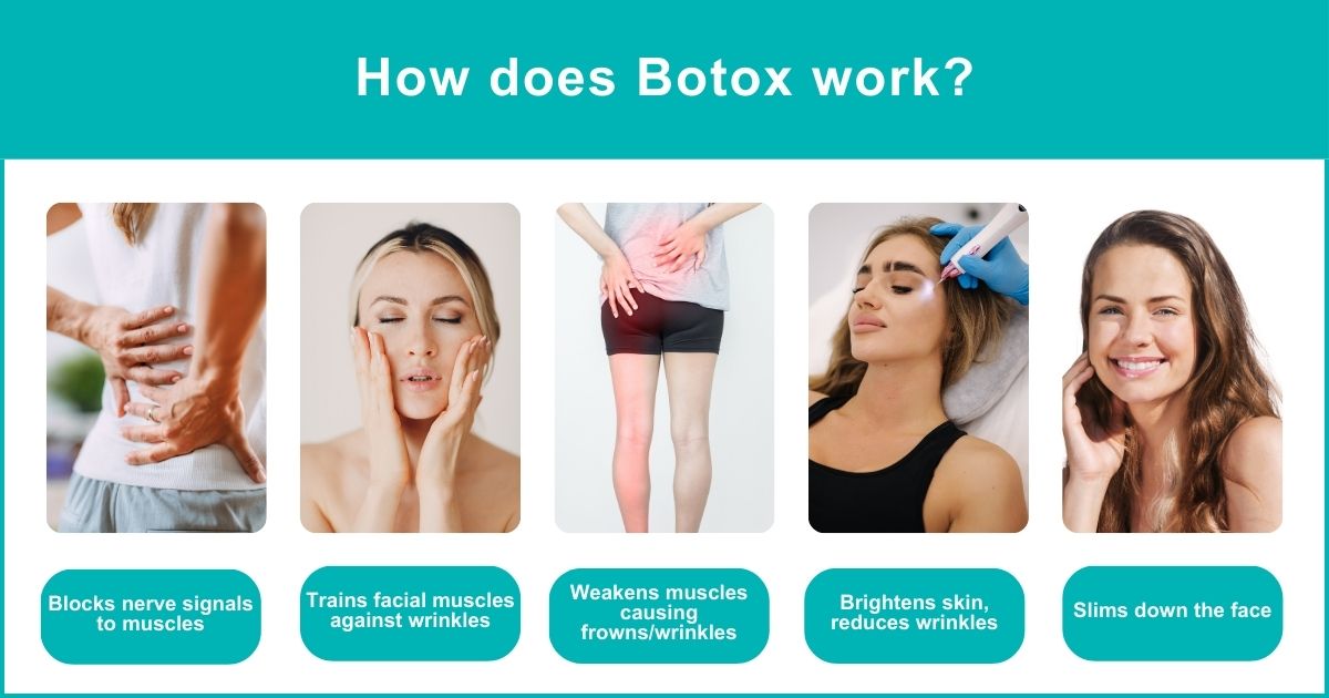 Botox Injections: How Do They Change Your Body? 2026