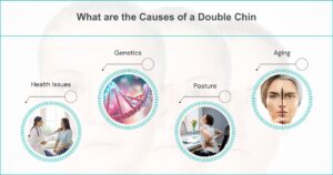 6 Causes Of Double Chin | Thyroid, Genetics, Or Posture 2025