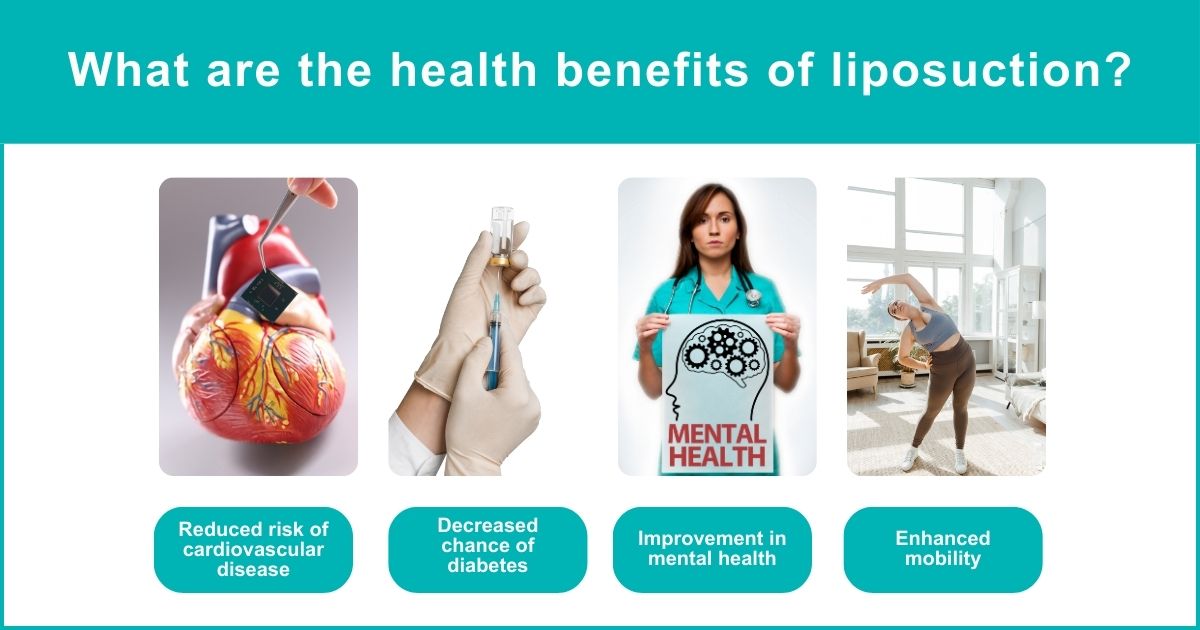 A Comprehensive Look At How Liposuction Contributes To Overall Health