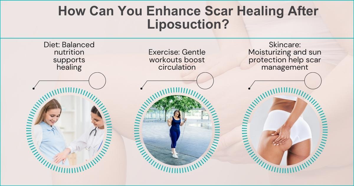 Scar Reduction After Thigh Liposuction: Tips 2025