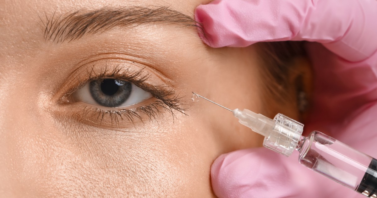 Under-Eye Fillers: All You Need To Know 2025