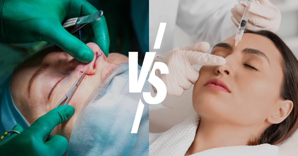 Nose Reshaping With Botox: What To Know? 2025