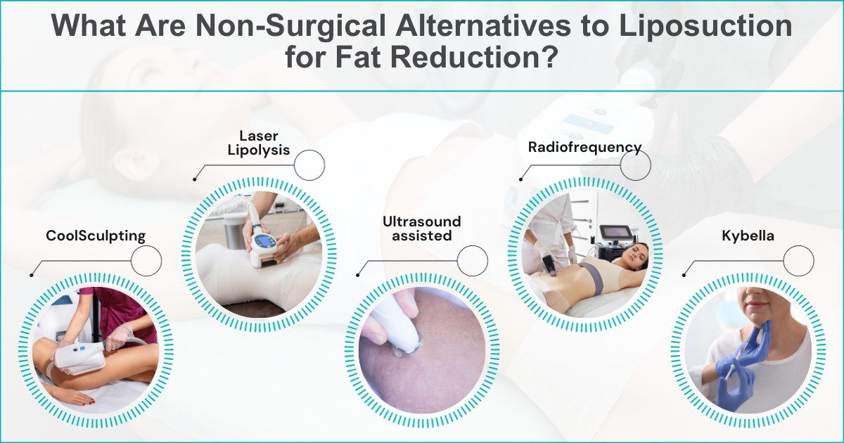 What Are The Alternatives To Liposuction For Fat Reduction?