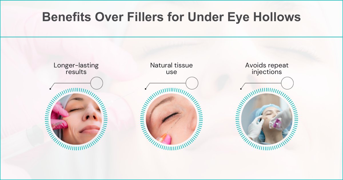 Lower Lid Blepharoplasty With Fat Transfer 2026
