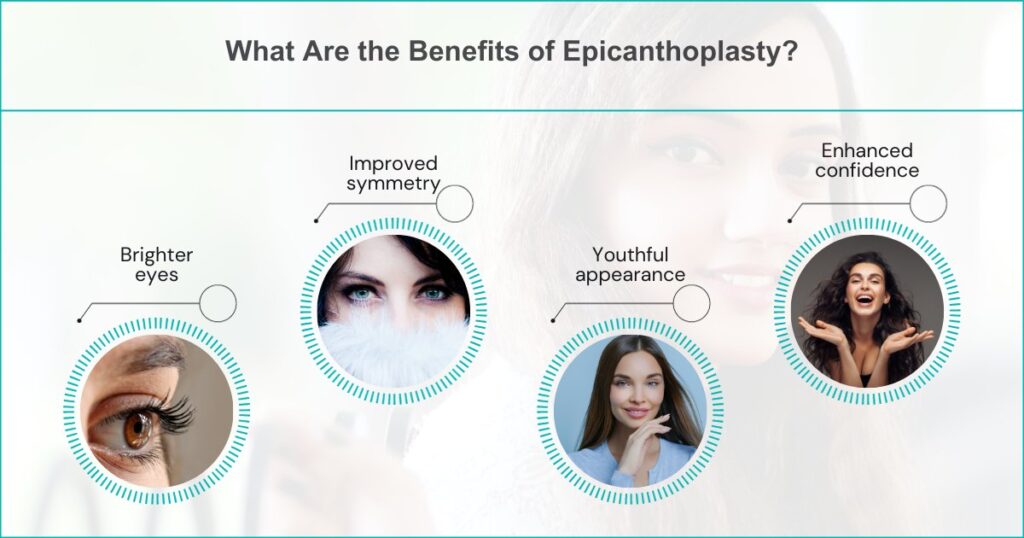 Epicanthoplasty And Blepharoplasty 2024
