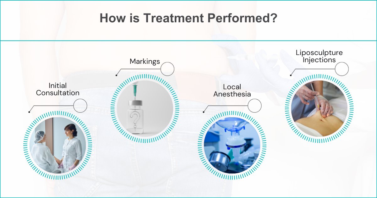 Liposculpture Injection: All You Need To Know 2024
