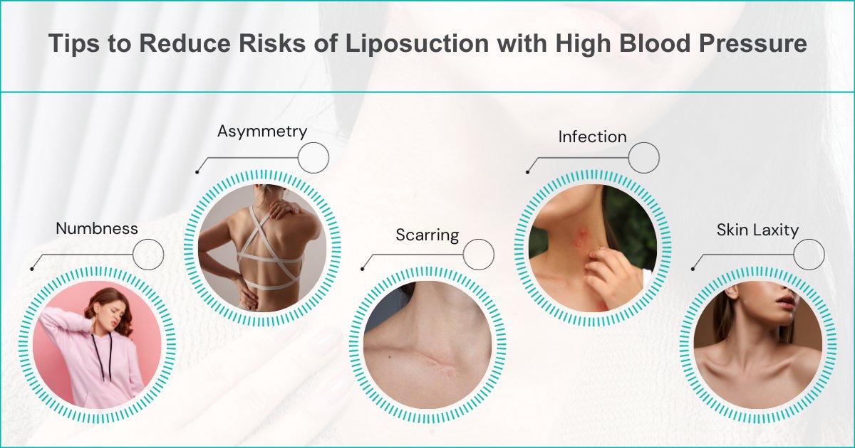 Is Neck Liposuction Safe: A Comprehensive Guide 2025