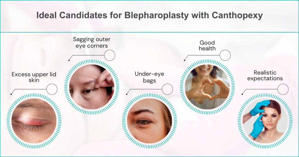 Blepharoplasty With Canthopexy 2024