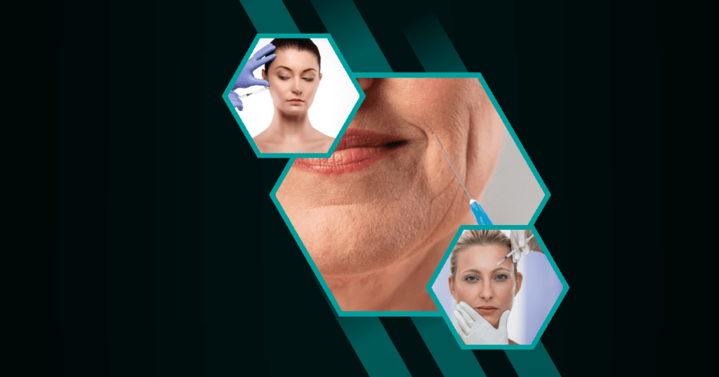 Botox Long Term Effects: What You Need To Know 2026