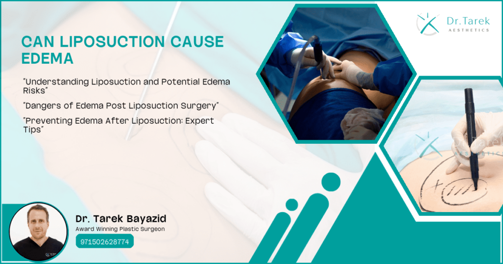 Can Liposuction Cause Edema 2025
